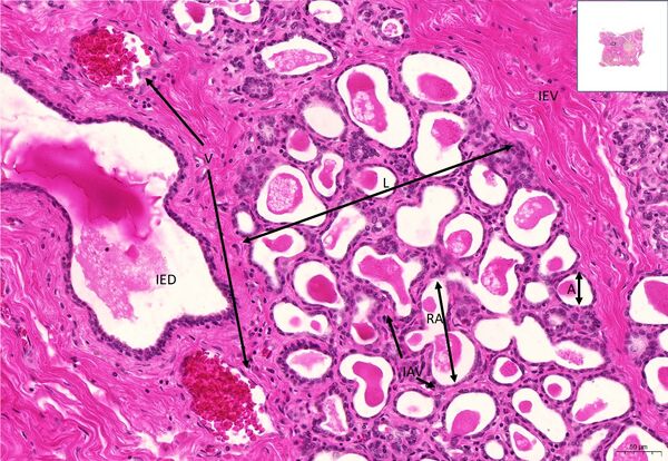 Mamma lactans - HE - WikiLectures