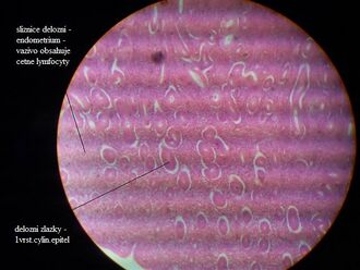 Female genital system (histology) - WikiLectures