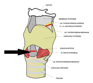 Coniotomy - WikiLectures