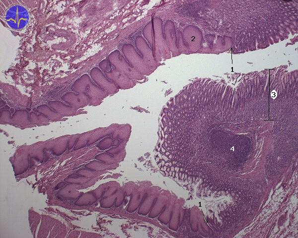 Gaster - cardia (SFLT) - WikiLectures