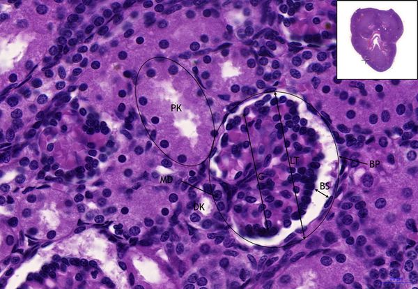 Kidney - HE - WikiLectures