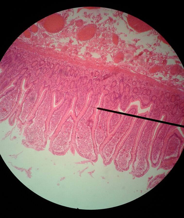 Small intestine (specimen) - WikiLectures