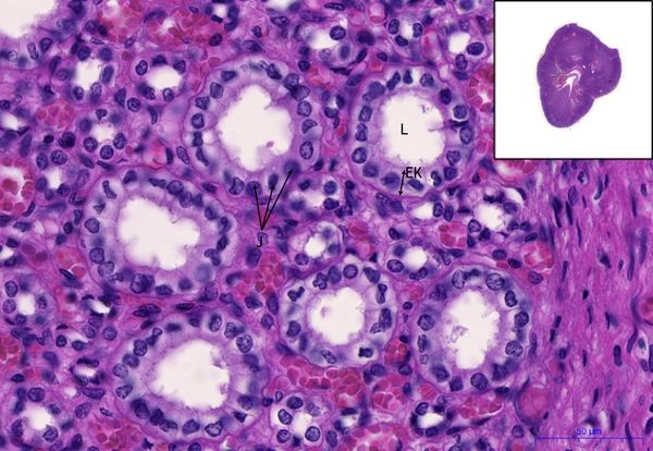 Kidney - HE - WikiLectures
