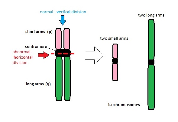 Isochromosomes - WikiLectures