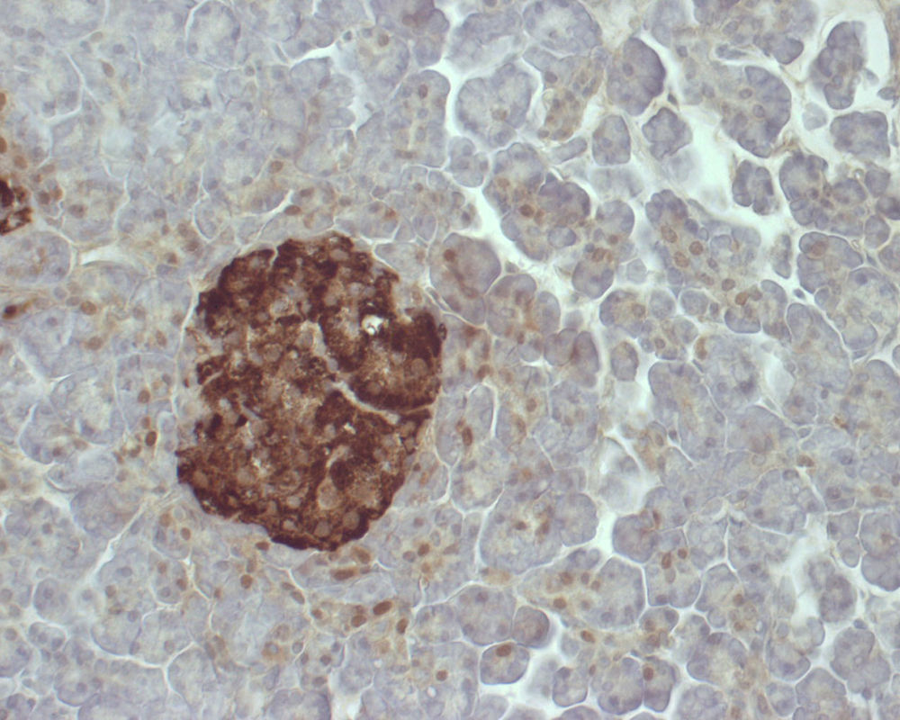 Pancreas (preparation) - WikiLectures