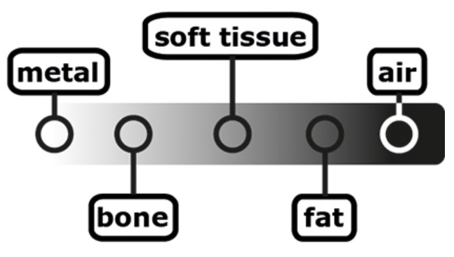 Sciagraphy and fluoroscopy - WikiLectures