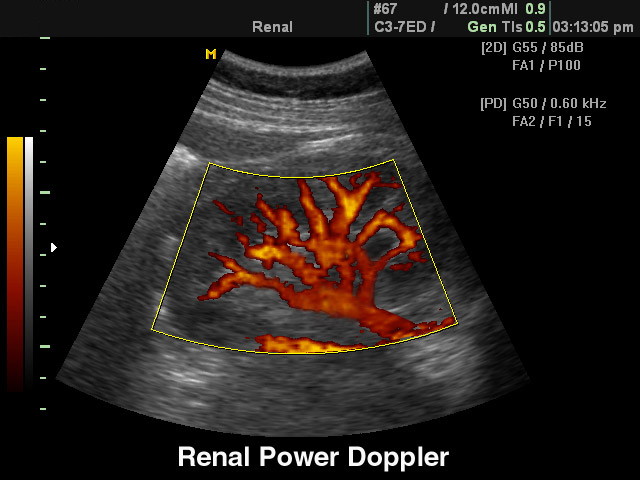 Doppler sonography/types and outputs - WikiLectures