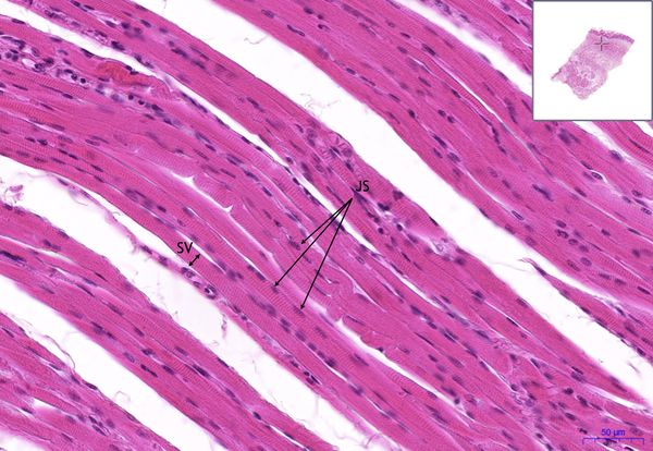Skeletal muscle - HE - WikiLectures