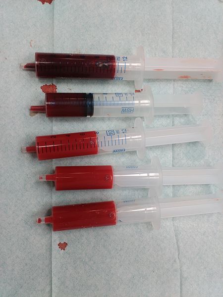 Hemoglobin and its derivatives - WikiLectures