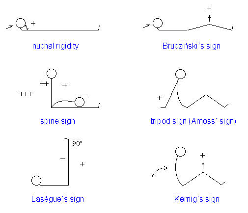 Meningism - WikiLectures
