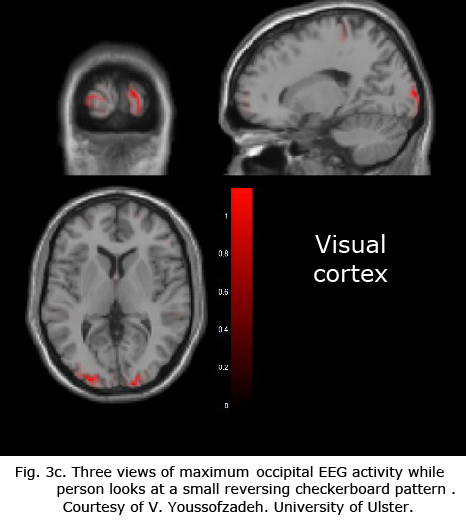 Native record and provoking tests - WikiLectures
