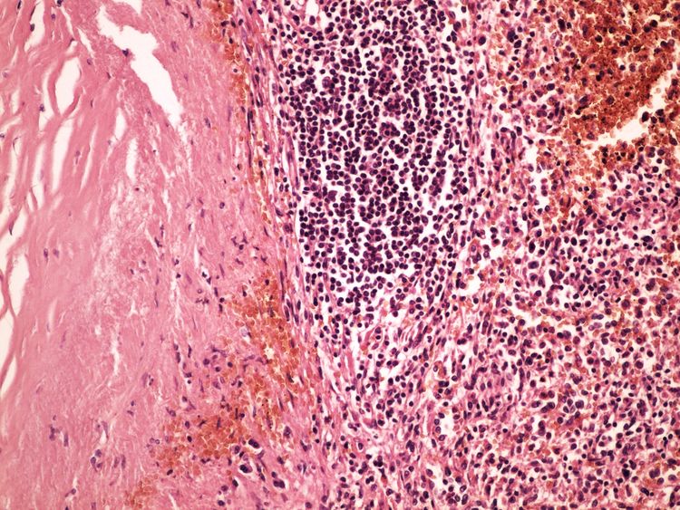 OZPP module - Practicum No. 3 - WikiLectures