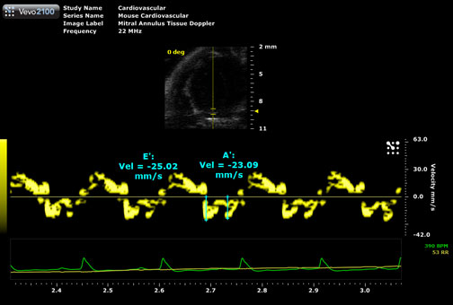 Doppler sonography/types and outputs - WikiLectures