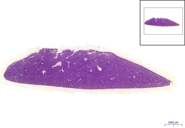 Liver - PAS - WikiLectures