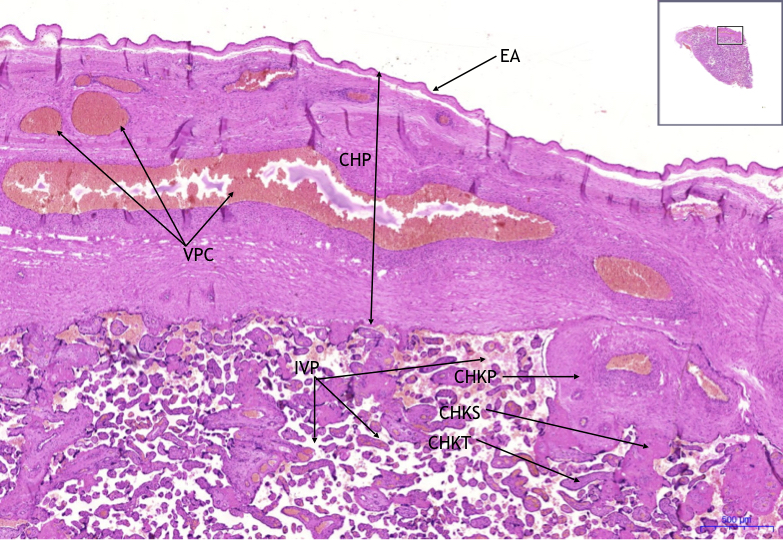 Placenta - HE - WikiLectures