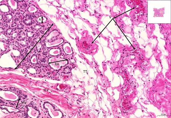 Mamma lactans - HE - WikiLectures