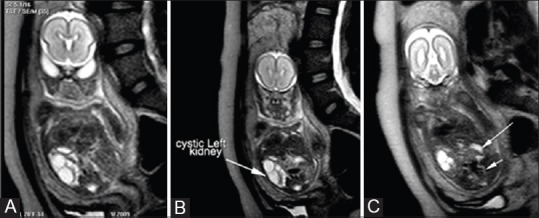 Amniotic fluid - WikiLectures