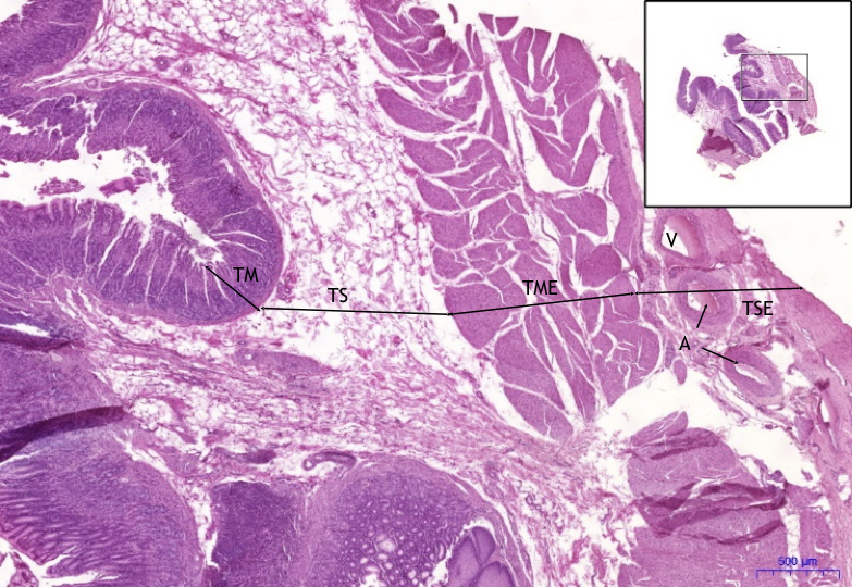 Stomach cardia - HE - WikiLectures