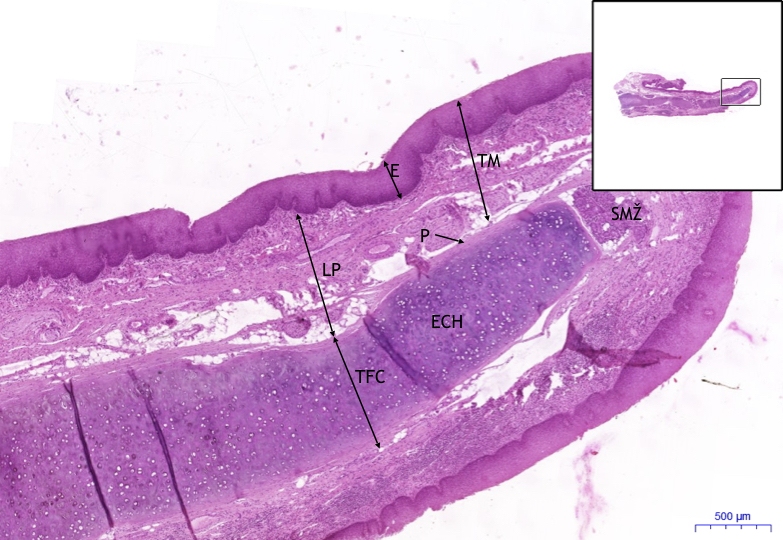 Epiglottis - HE - WikiLectures