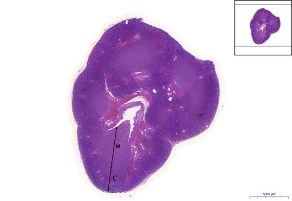 Kidney - HE - WikiLectures