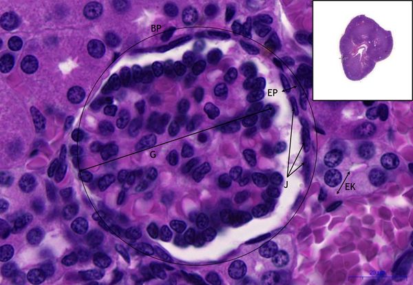 Kidney - HE - WikiLectures