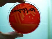 Streptococcus - WikiLectures