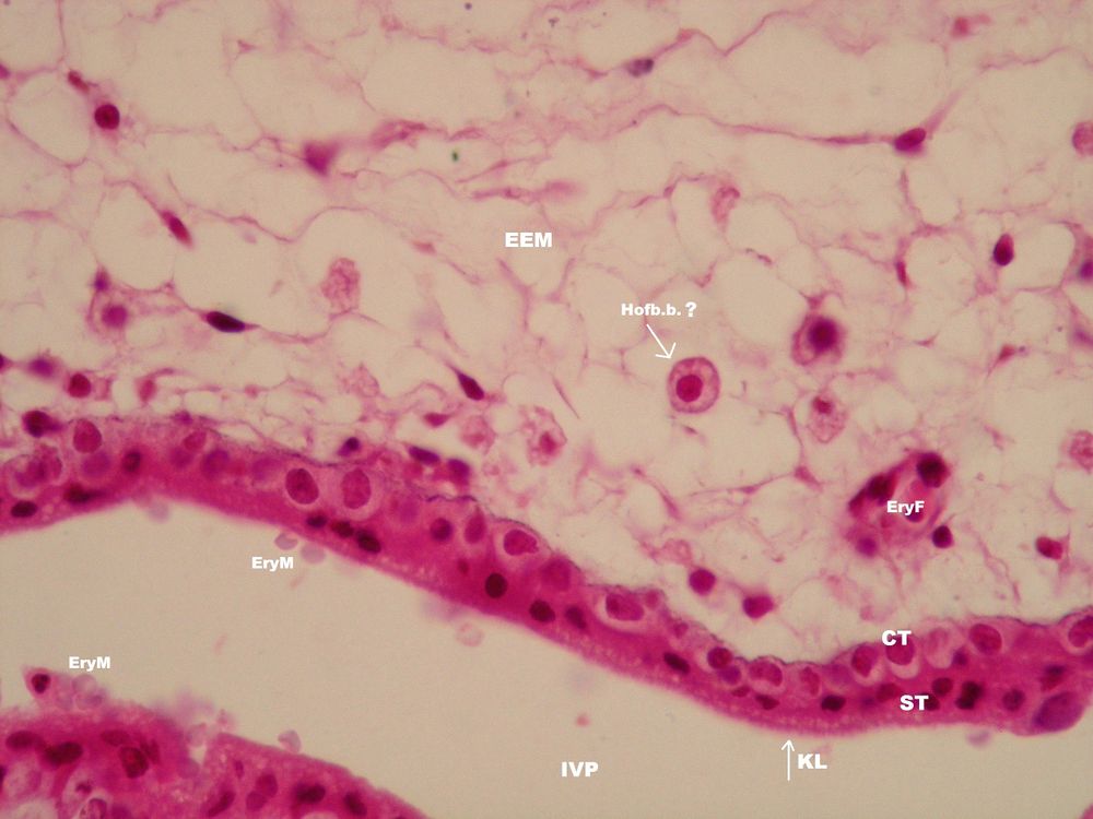 Placenta (SFLT) - WikiLectures
