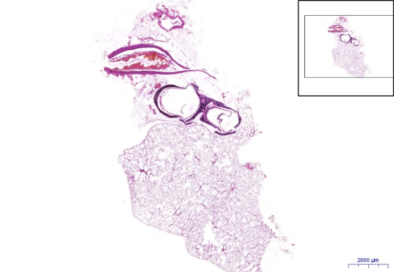 Lung HE - WikiLectures