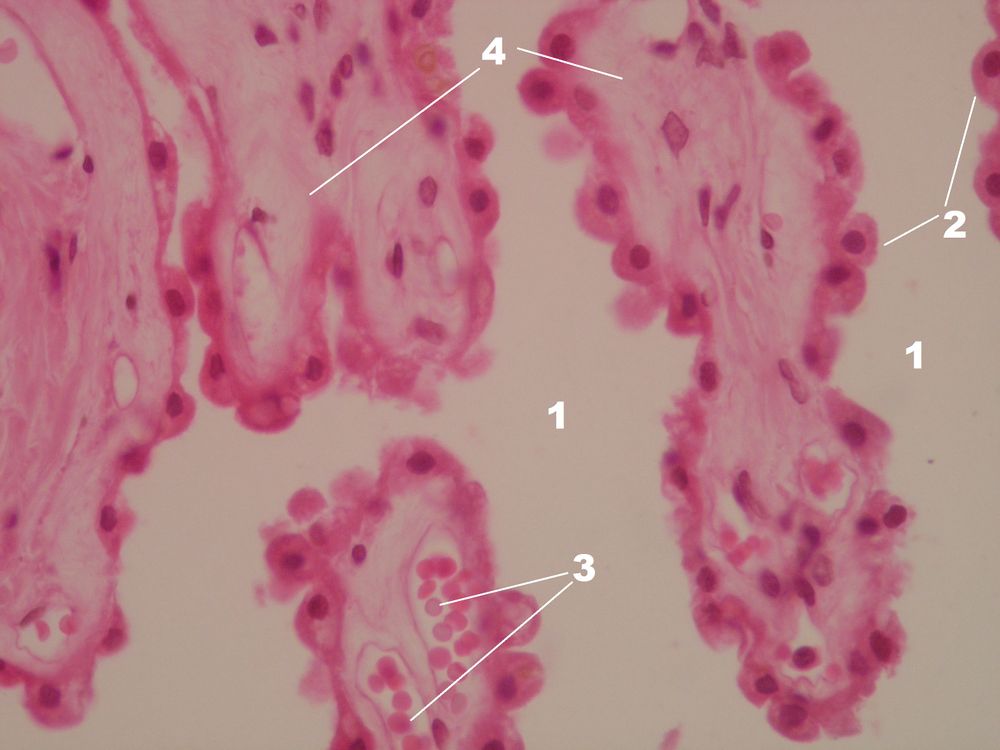 Plexus choroideus (SFLT) - WikiLectures