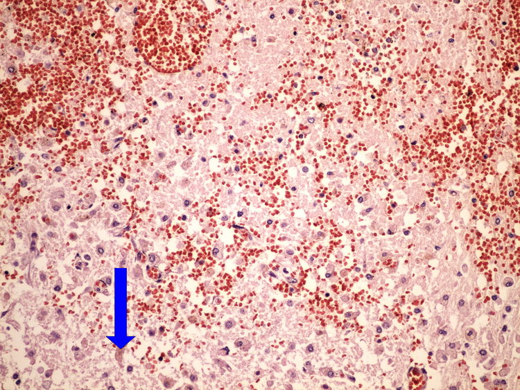 OZPP module - Practicum No. 2 - WikiLectures