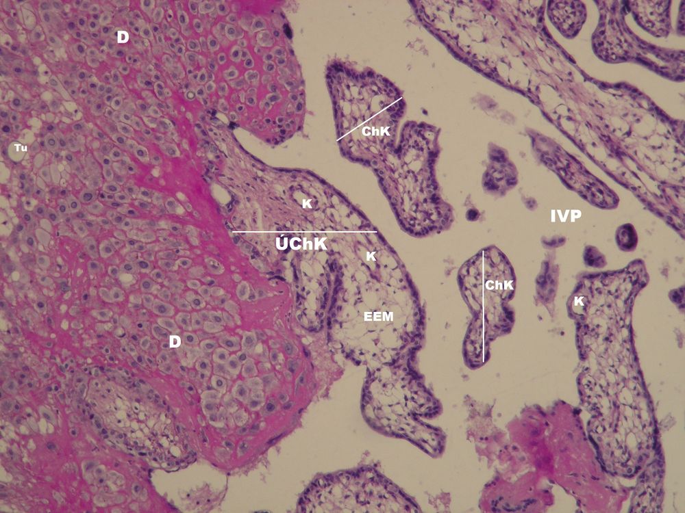 Placenta (SFLT) - WikiLectures