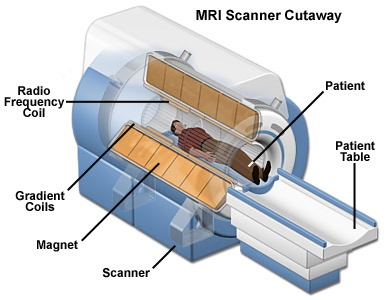 MAGNETIC RESONANCE IMAGING (MRI) - WikiLectures
