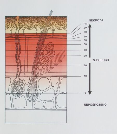 Transition zone and thermal gradients - WikiLectures