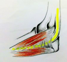 Cubital Canal - WikiLectures