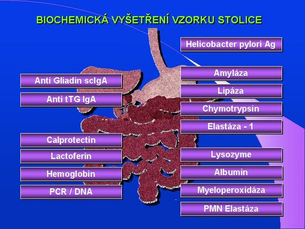 Stool examination - WikiLectures