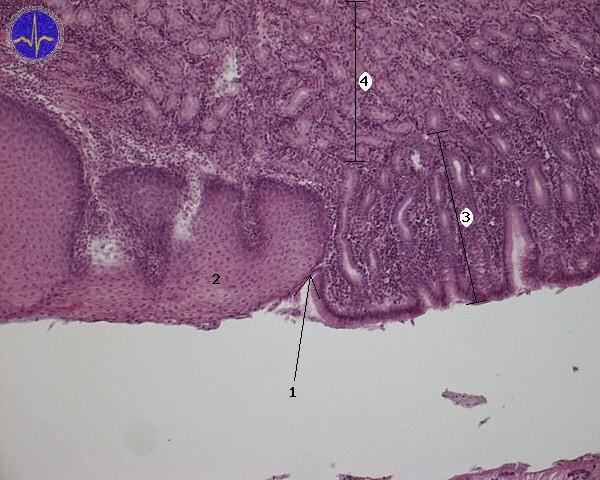 Gaster - cardia (SFLT) - WikiLectures