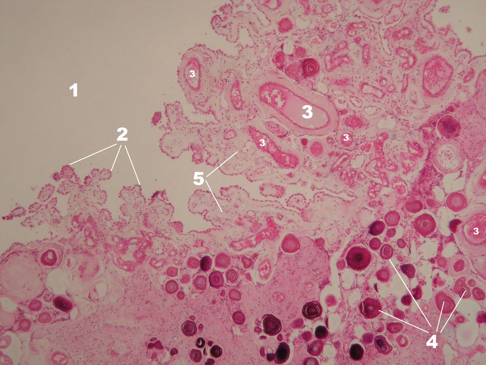 Plexus choroideus (SFLT) - WikiLectures