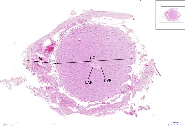 Nervus opticus - HE - WikiLectures